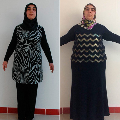 Lemon Strike Complex